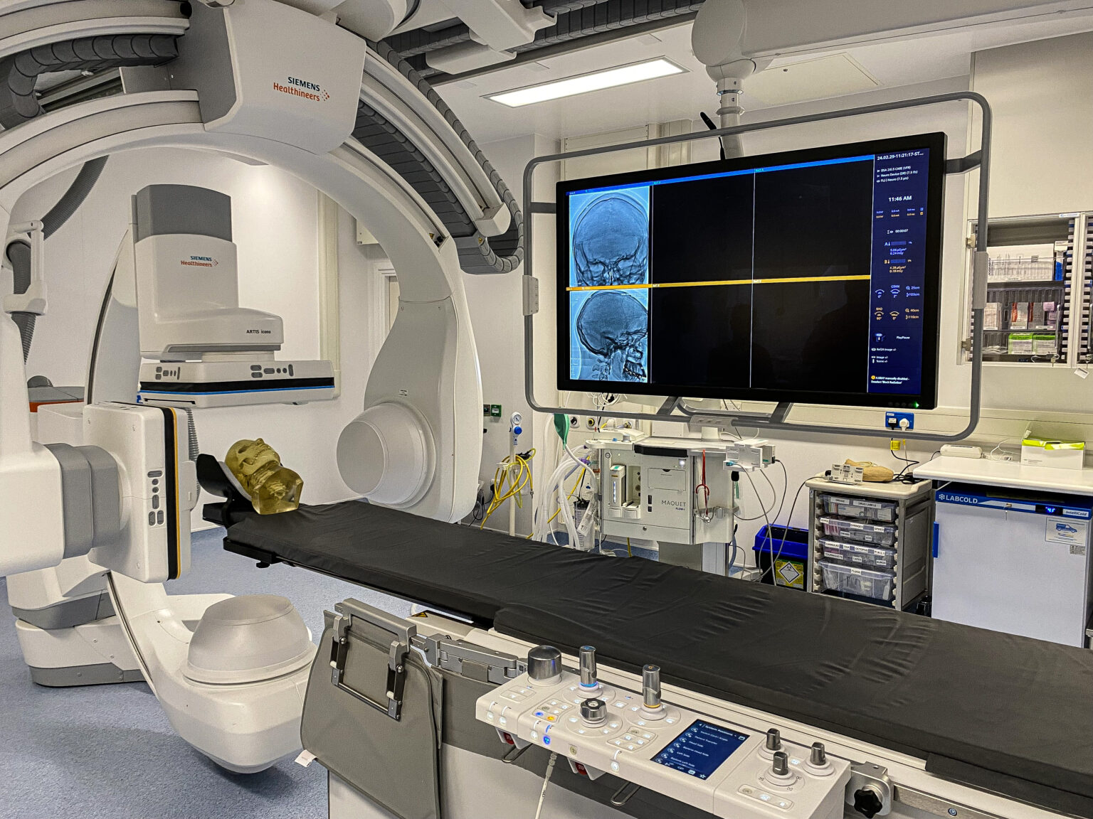 NHSGGC opens new West of Scotland Thrombectomy Service - NHSGGC